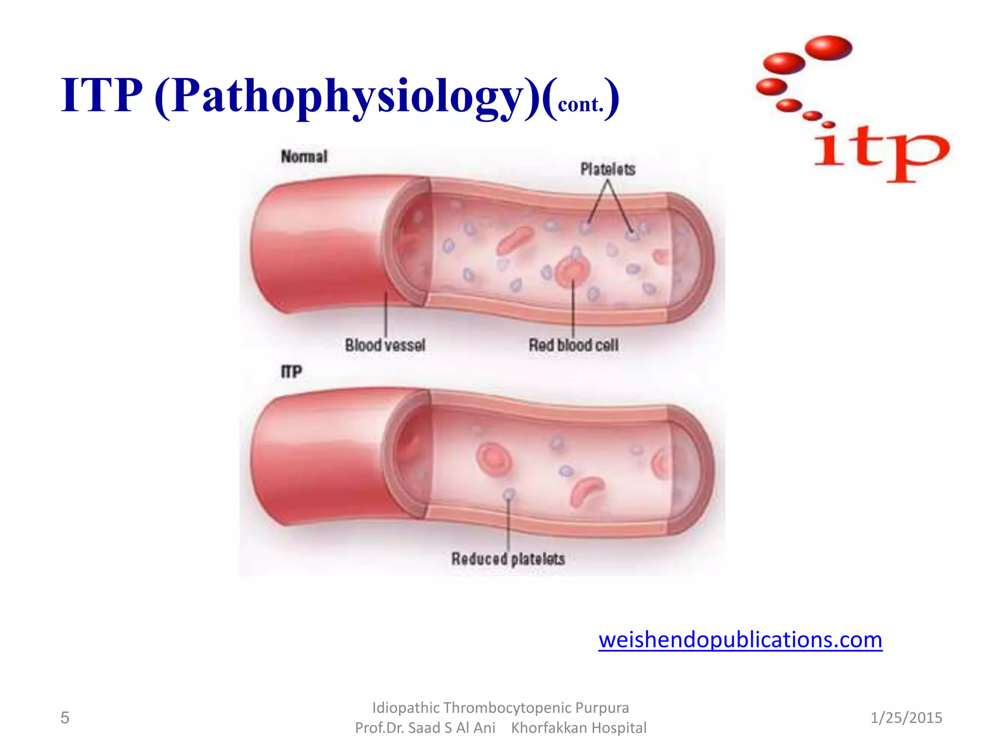 Idiopathic (autoimmune) Thrombocytopenic Purpura | PPTX