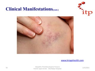 Idiopathic (autoimmune) Thrombocytopenic Purpura | PPTX