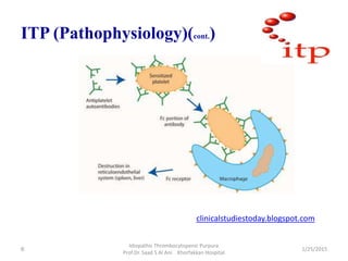 Idiopathic (autoimmune) Thrombocytopenic Purpura | PPTX