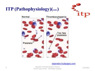 Idiopathic (autoimmune) Thrombocytopenic Purpura | PPTX