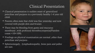 Immune thrombocytopenic purpura(ITP) .pptx