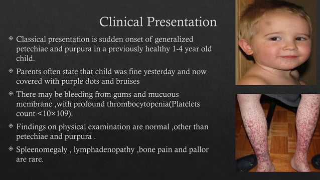 Immune thrombocytopenic purpura(ITP) .pptx