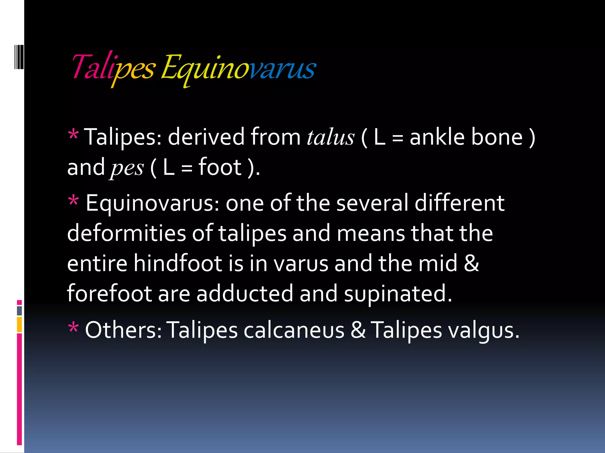 Idiopathic club foot | PPTX