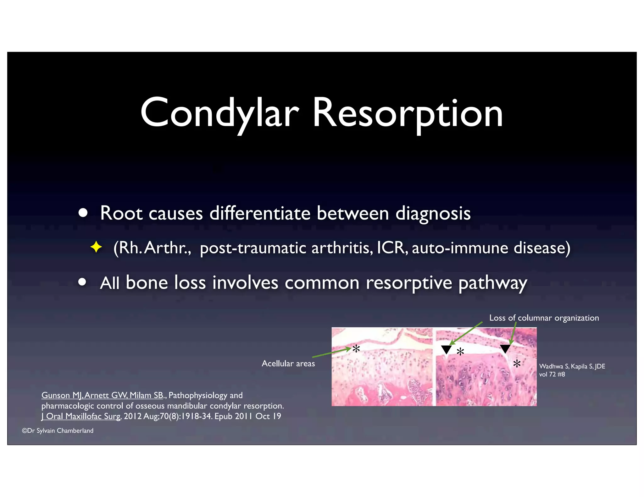 Idiopathic condylar resorption and arthrosis of the joints | PDF