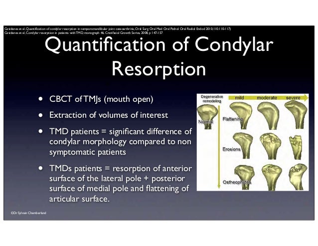 Idiopathic condylar resorption and arthrosis of the joints