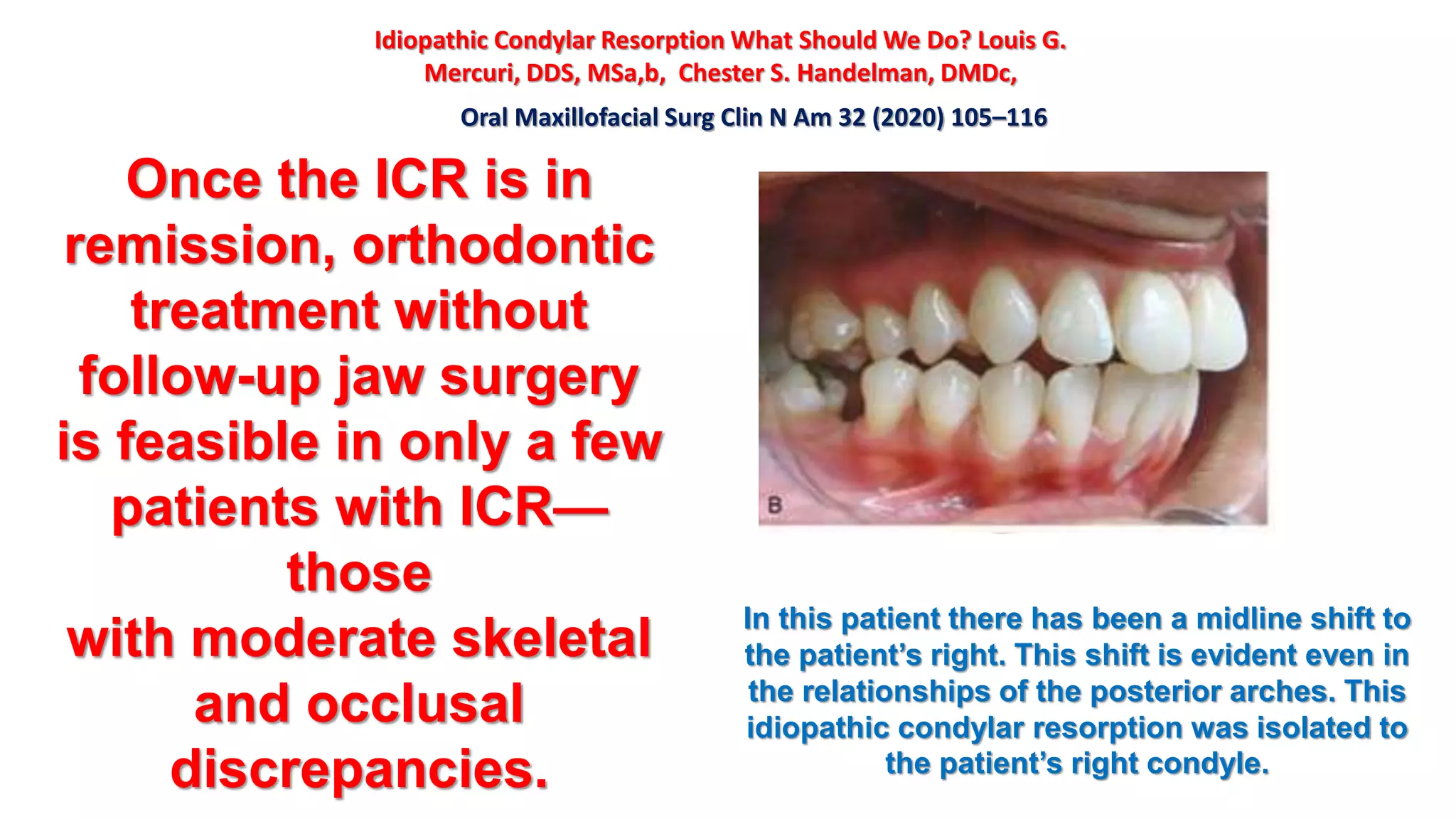 orthodontic management of Idiopathic condylar resorption part 2 | PPT