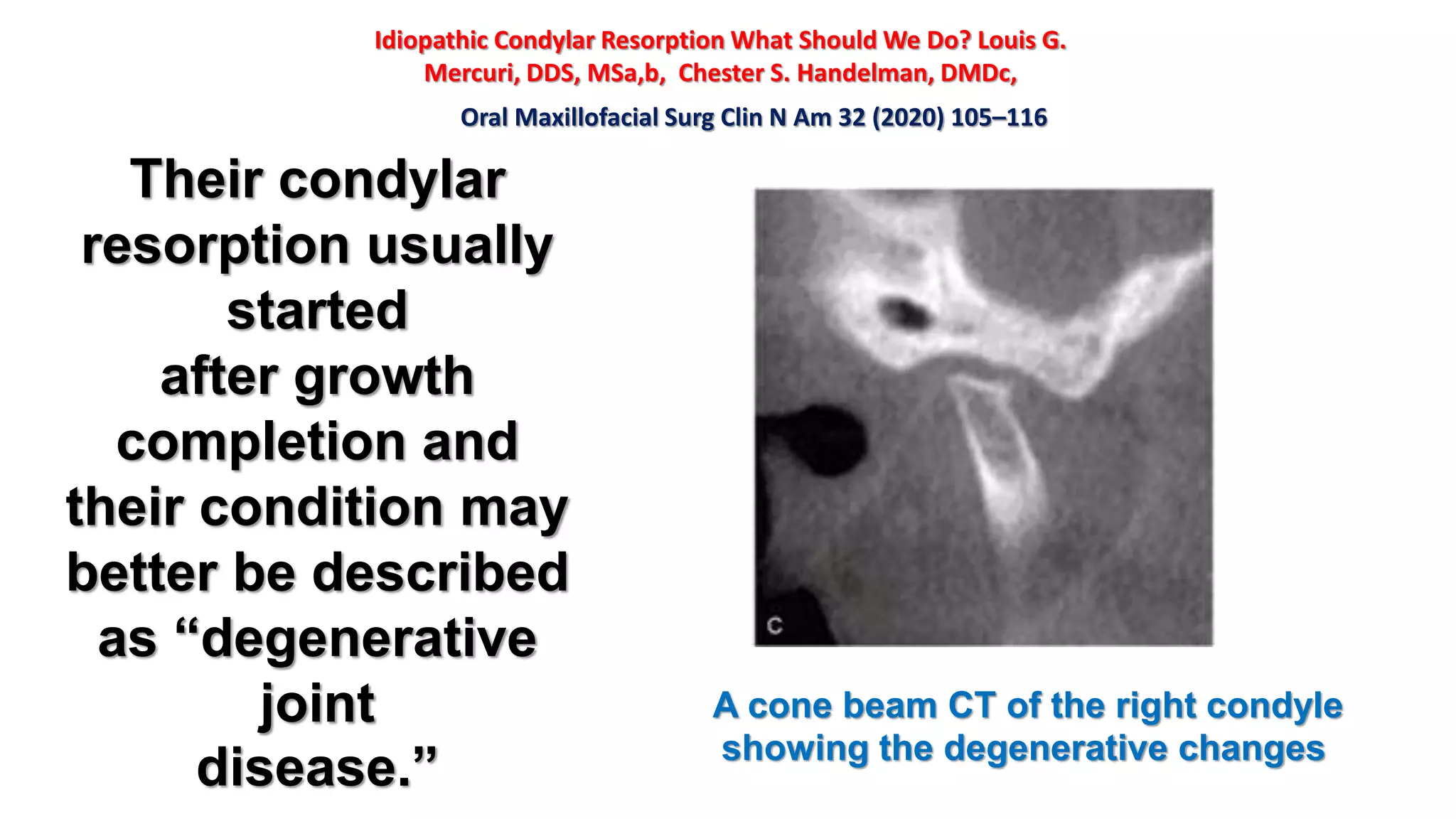 orthodontic management of Idiopathic condylar resorption part 2 | PPT
