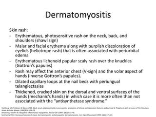 Idiopathic Inflammatory Myopathies | PPTX