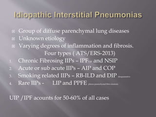 Idiopathic interstitial pneumonias 1 | PPTX