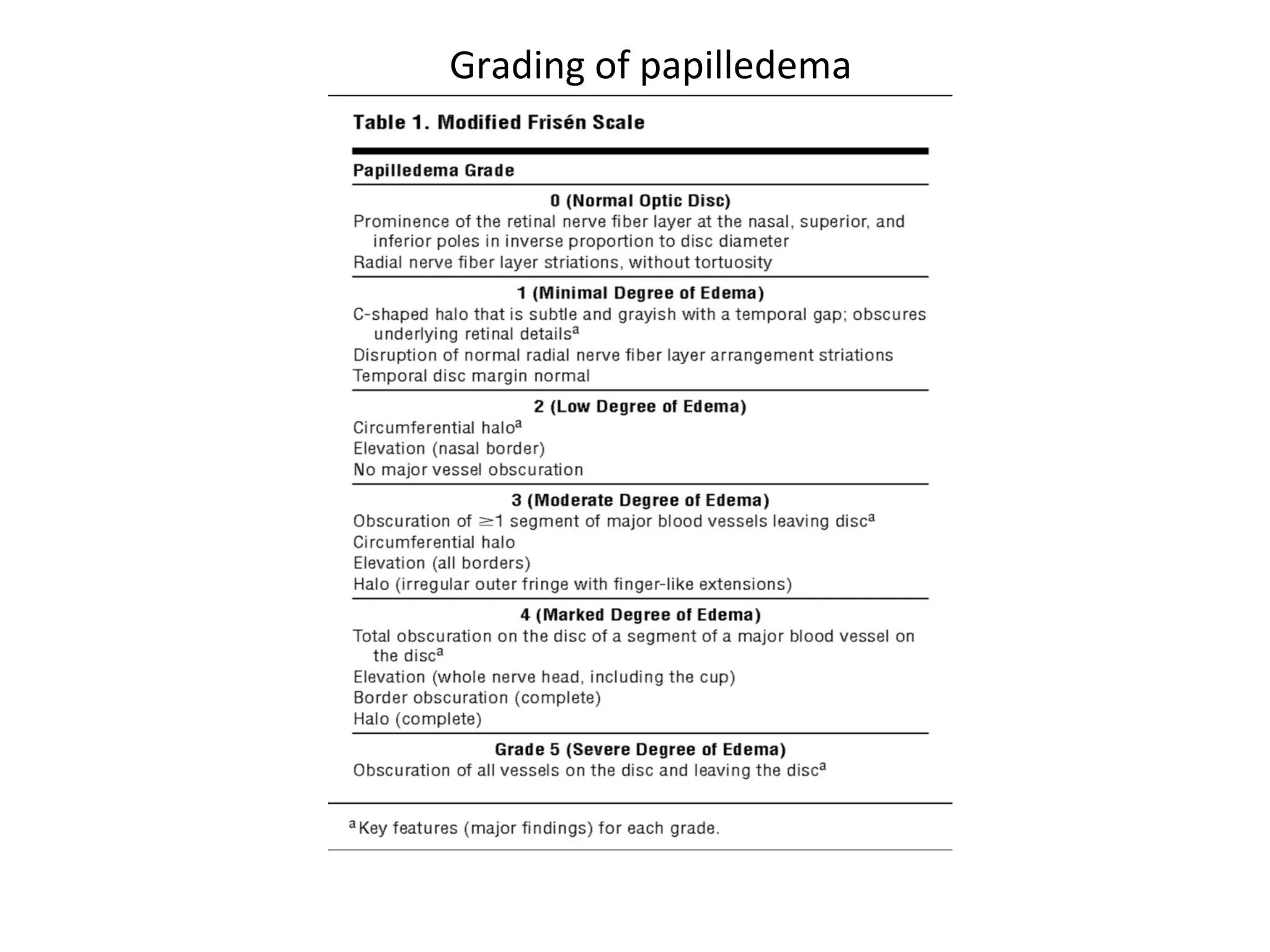 Idiopathic intracranial hypertension | PPT