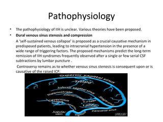 Idiopathic intracranial hypertension | PPT