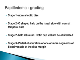 Idiopathic intracranial hypertension | PPT