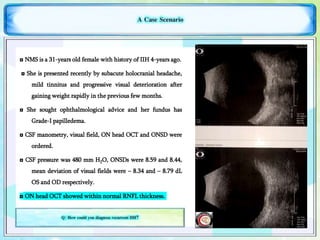 Idiopathic intracranial hypertension, Looking for the black cat in the ...
