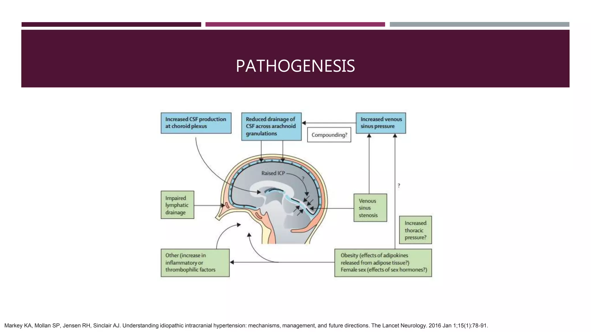 Idiopathic Intracranial Hypertension | PPTX