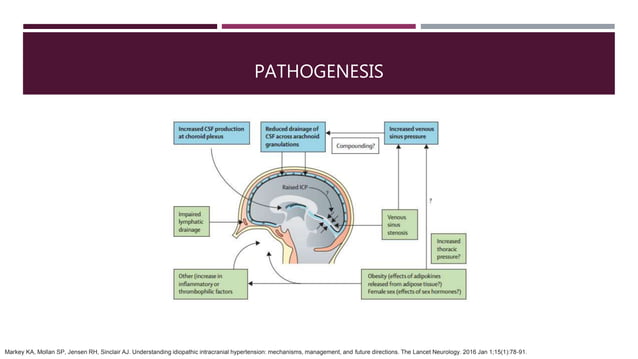 Idiopathic Intracranial Hypertension | PPTX | Brain and Nervous System ...