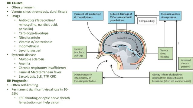 Idiopathic intracranial hypertension (pseudotumor cerebri) | PPTX | Ear ...