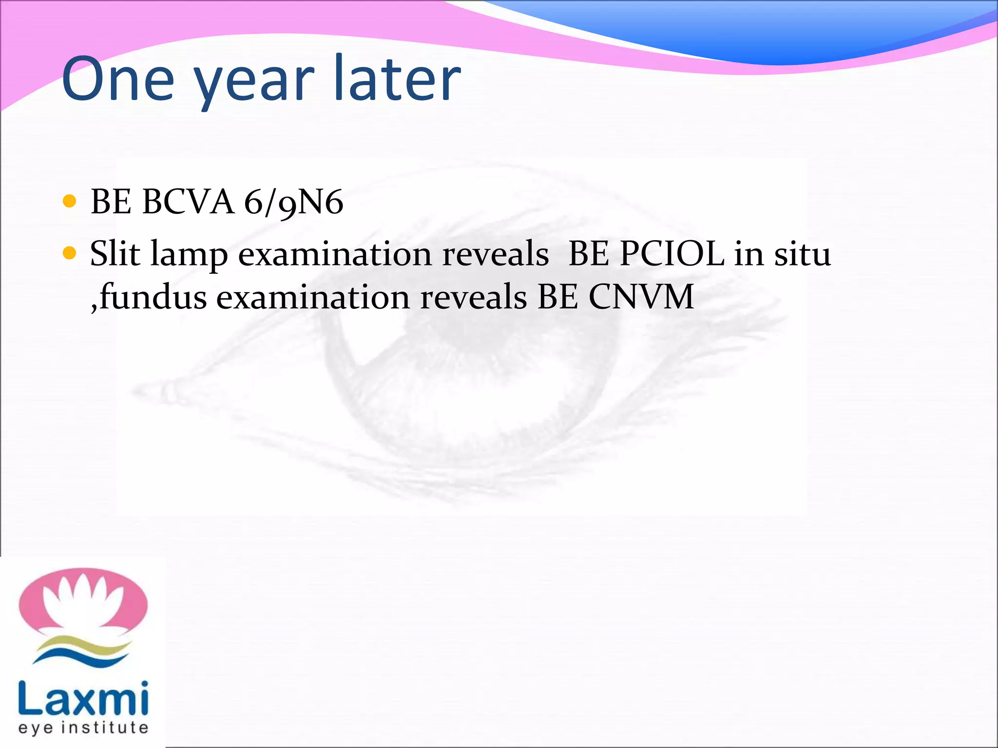 Idiopathic polypoidal choroidal vasculopathy | PPTX