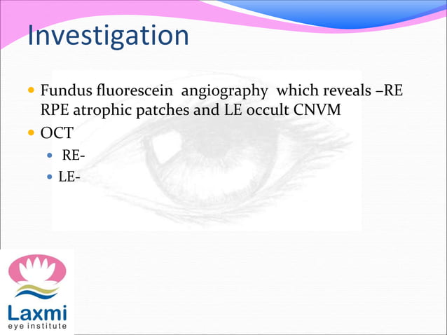 Idiopathic polypoidal choroidal vasculopathy | PPTX