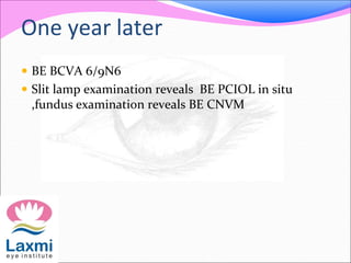 Idiopathic polypoidal choroidal vasculopathy | PPTX