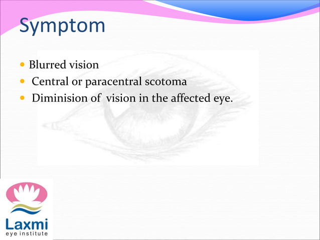 Idiopathic polypoidal choroidal vasculopathy | PPTX