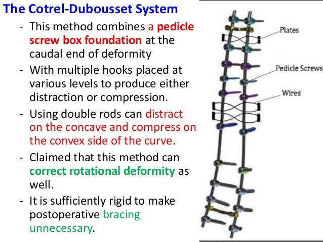 Idiopathic scoliosis