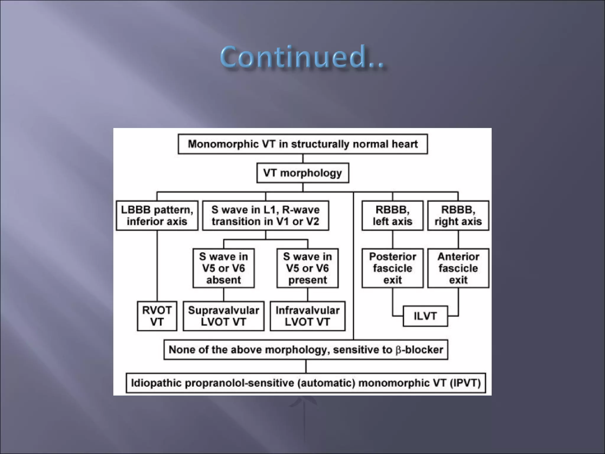 Idiopathic ventricular tachycardia | PPT