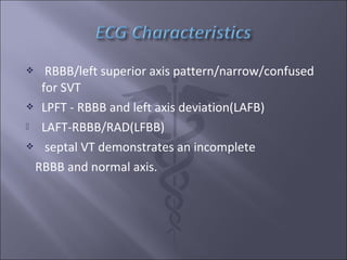 Idiopathic ventricular tachycardia | PPT