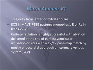Idiopathic ventricular tachycardia | PPT