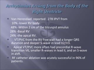 Idiopathic ventricular tachycardia | PPT