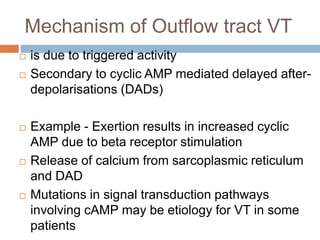 Idiopathic Ventricular Tachycardia (VT) | PPTX