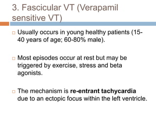 Idiopathic Ventricular Tachycardia (VT) | PPTX