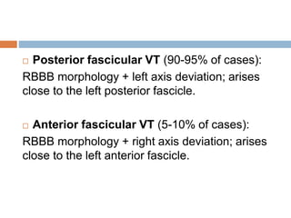 Idiopathic Ventricular Tachycardia (VT) | PPTX