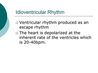 Idioventricular.ppt