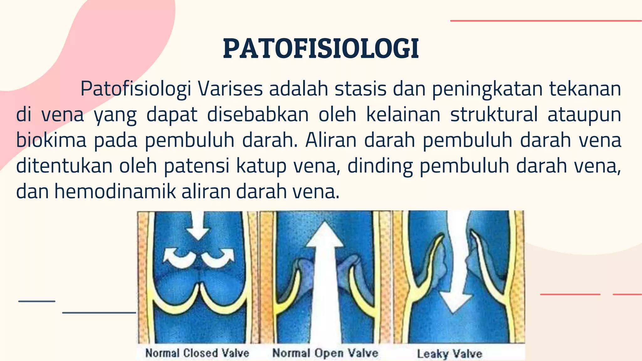 Penyakit Vaskularr | PPTX