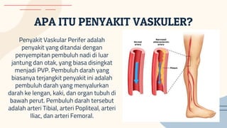 Penyakit Vaskularr | PPTX