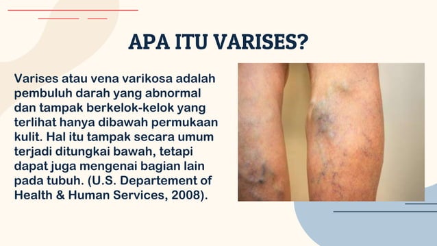 Penyakit Vaskularr | PPTX