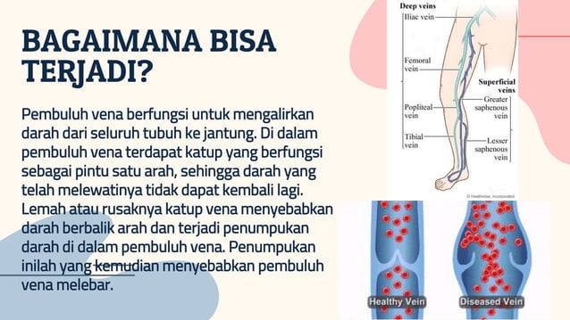 Penyakit Vaskularr | PPTX