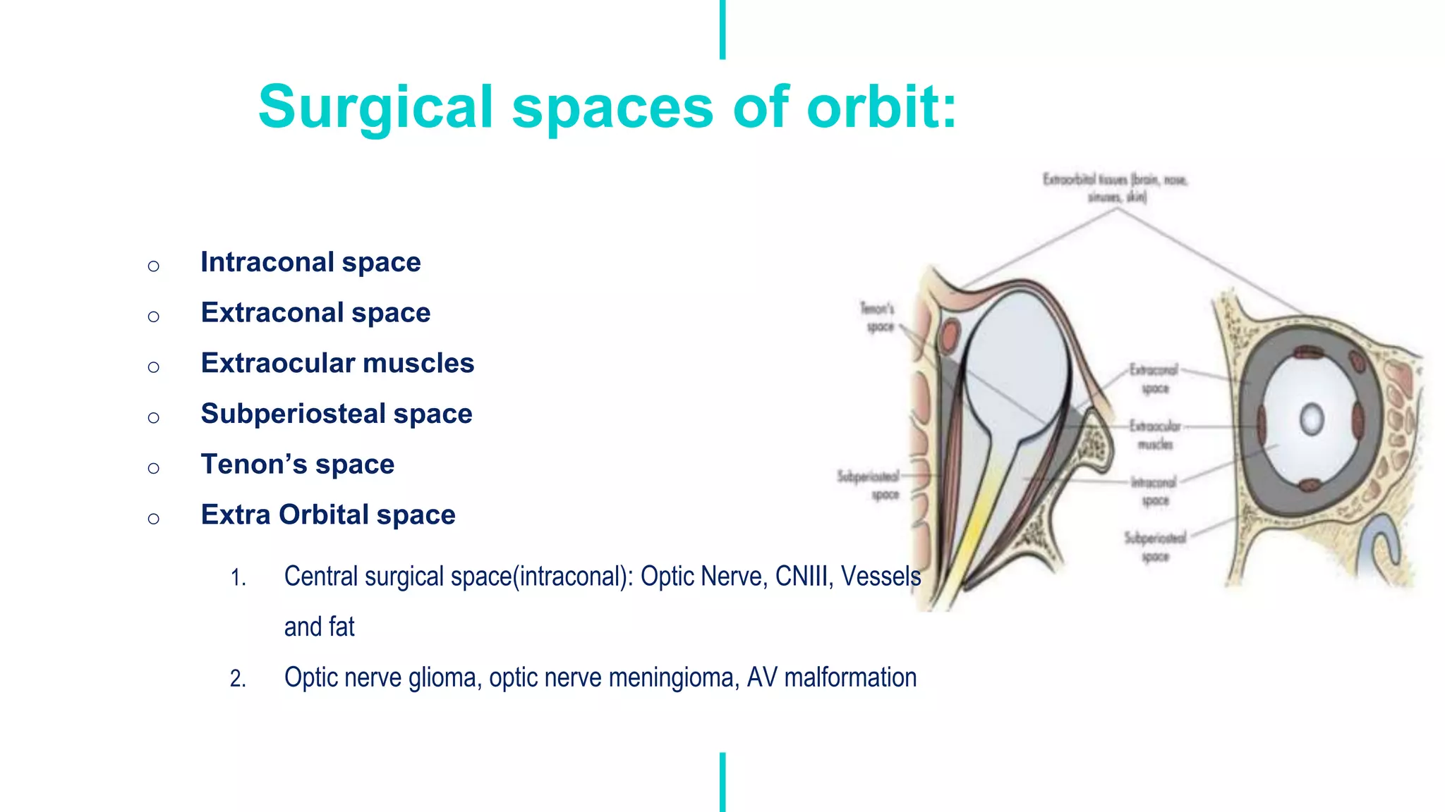 Approach to the case of PROPTOSIS | PPTX