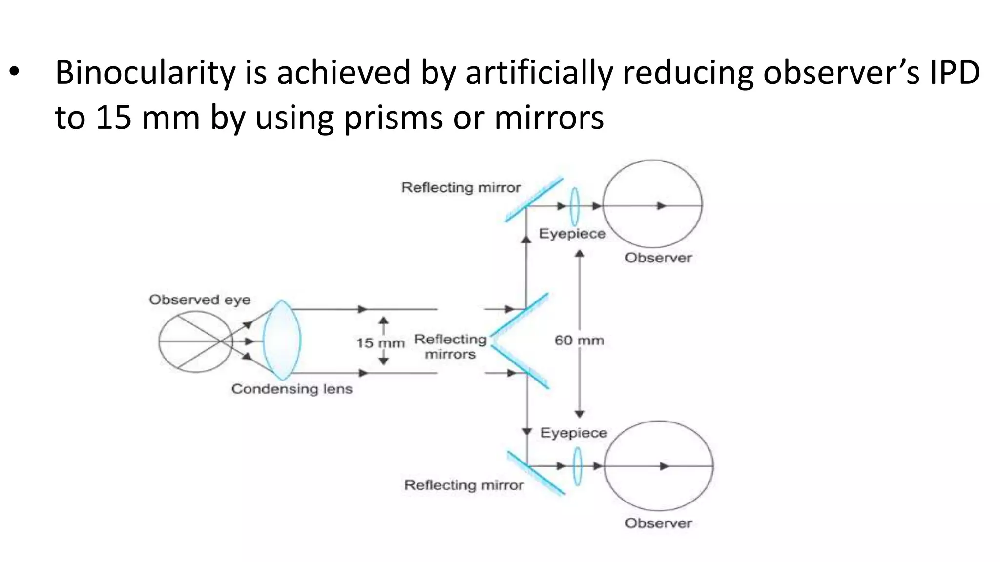 Binocular Indirect Ophthalmoscopy | PPTX
