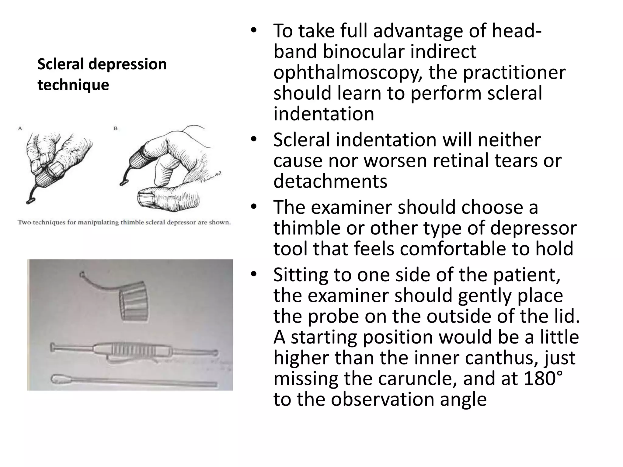 Indirect Ophthalmoscopy and slit lamp biomicroscopy | PPTX