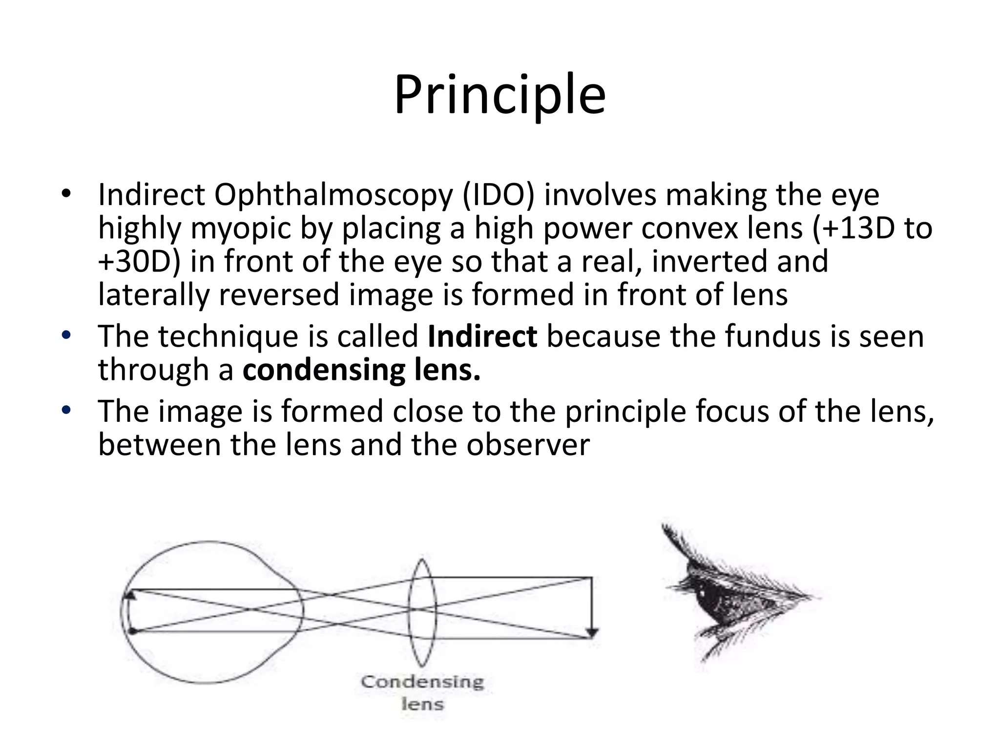 Indirect Ophthalmoscopy and slit lamp biomicroscopy | PPTX