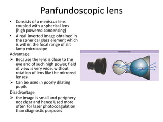 Indirect Ophthalmoscopy and slit lamp biomicroscopy | PPTX