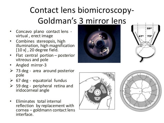 Indirect Ophthalmoscopy and slit lamp biomicroscopy