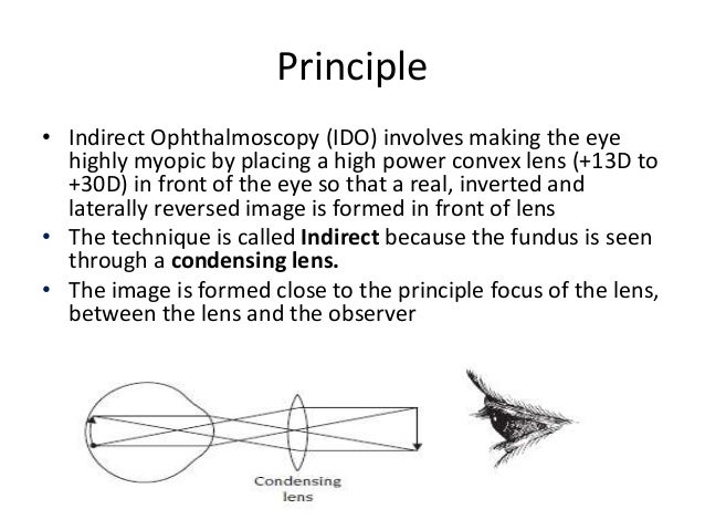 Indirect Ophthalmoscopy and slit lamp biomicroscopy