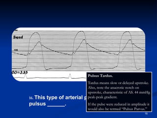 Id Pressure Waveforms | PPT