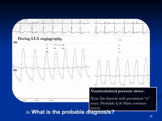 Id Pressure Waveforms | PPT