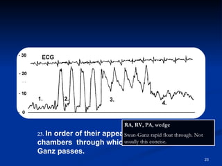 Id Pressure Waveforms | PPT