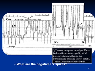 Id Pressure Waveforms | PPT