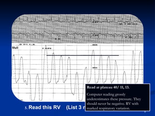 Id Pressure Waveforms | PPT
