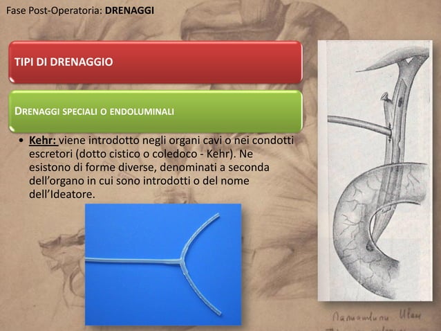 I drenaggi | PPT